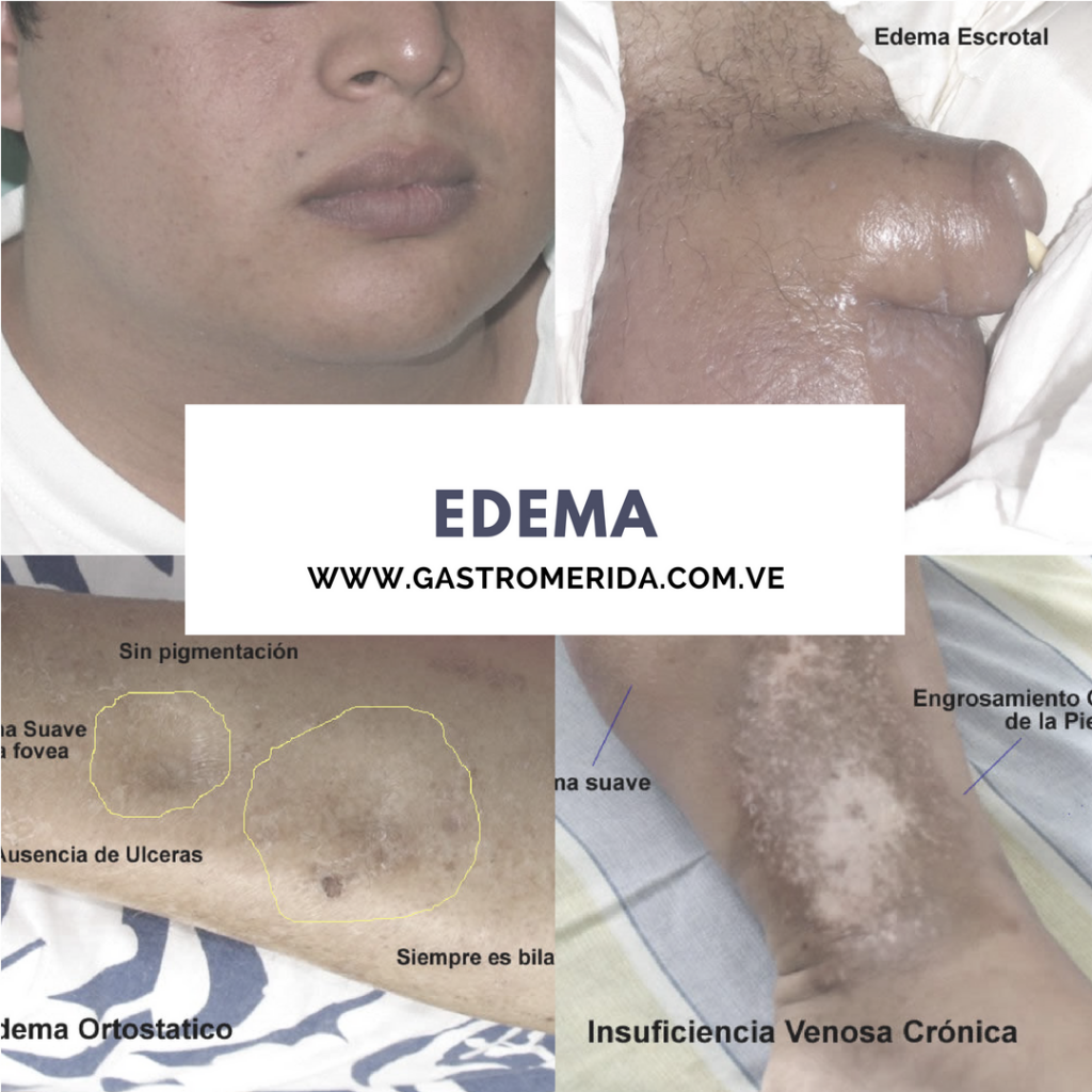 fóvea – Gastro Mérida