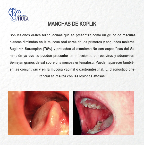 Alteraciones de la Boca – Gastro Mérida