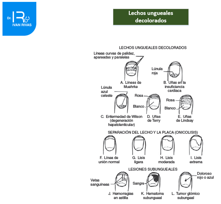 Alteraciones de las Uñas – Gastro Mérida