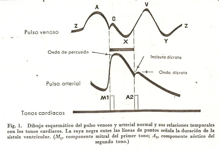 Pulso Arterial – Gastro Mérida