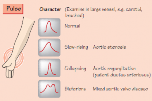 Pulso Arterial – Gastro Mérida