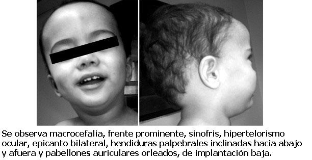 fACIES – Gastro Mérida