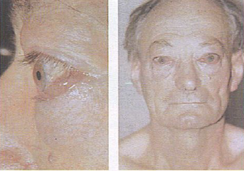 fACIES – Gastro Mérida