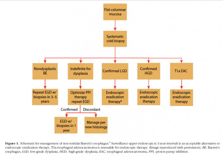 Esófago de Barrett – Gastro Mérida