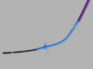 Manejo endoscópico de la Estenosis Biliar distal – Gastro Mérida