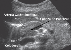 Ultrasonido de la Vesícula y el Árbol Biliar – Gastro Mérida