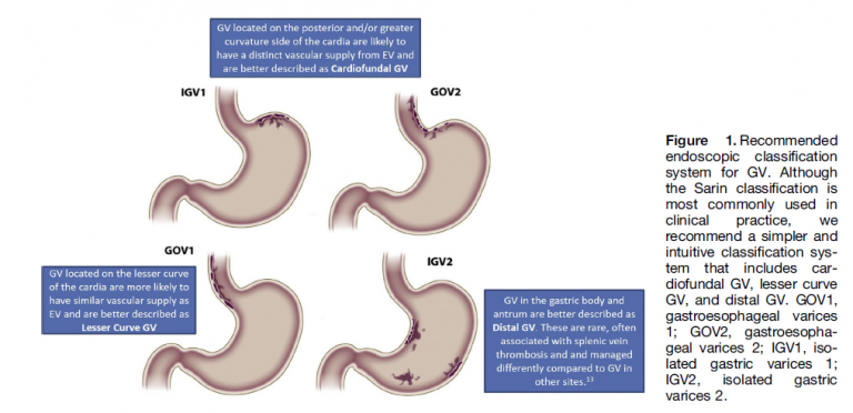 clasificación de Sarín – Gastro Mérida