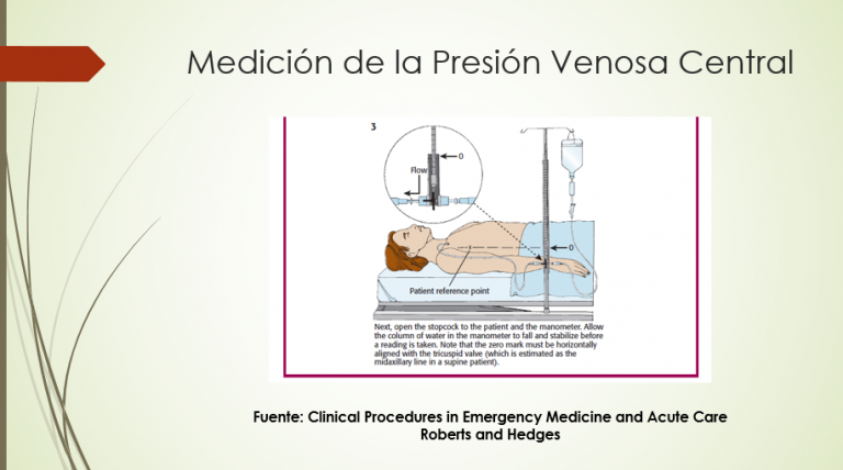 Emergencias Médicas: Técnicas de Venopunción – Gastro Mérida