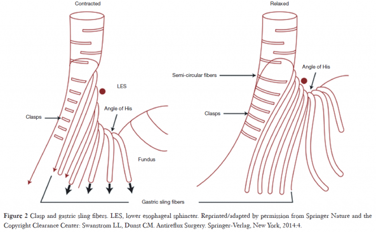 Unión Esofagogastrica – Gastro Mérida