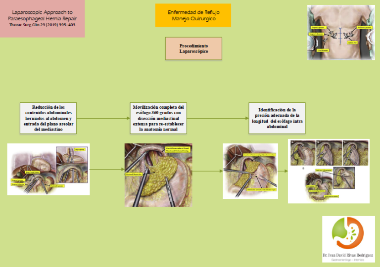 Algoritmos de buena práctica de la Union Esofagogastrica: Hernia Hiatal ...
