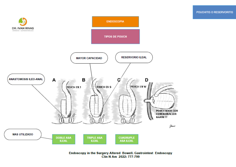 Algoritmos de buena práctica en diagnóstico y tratamiento de colitis ...
