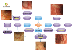 Algoritmos diagnósticos en Íleon y Ciego: Ileoscopia – Gastro Mérida
