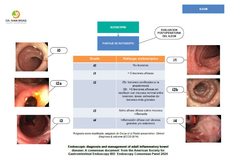 Algoritmos de buena práctica en diagnóstico y tratamiento de colitis ...