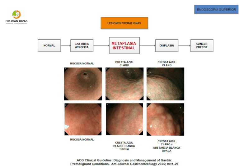 Algoritmos de buena práctica en lesiones premalignas: esofago, estomago ...