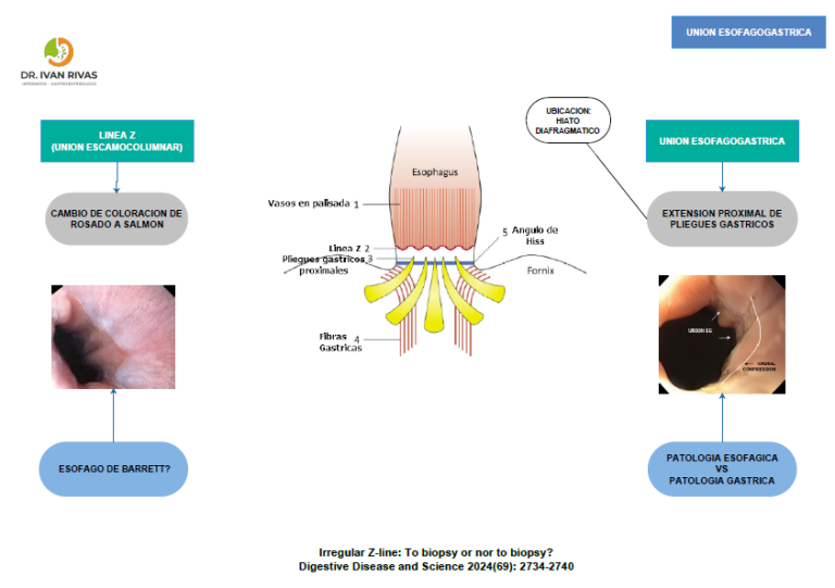 Algoritmos de buena práctica de la Union Esofagogastrica: Hernia Hiatal ...