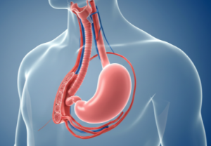 Algoritmos de buena práctica de la Union Esofagogastrica: Hernia Hiatal ...