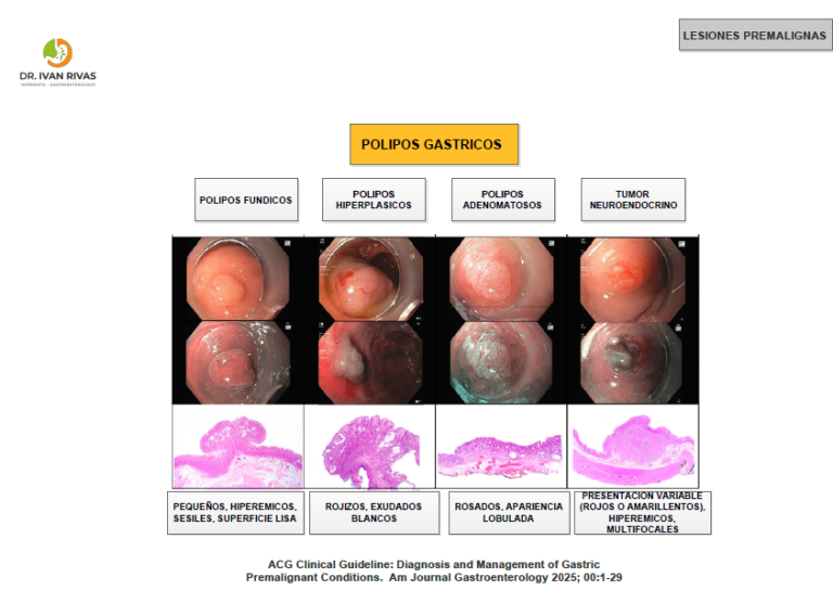 Algoritmos de buena práctica en lesiones premalignas: esofago, estomago ...