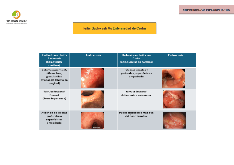 Algoritmos de buena práctica en diagnóstico y tratamiento de colitis ...