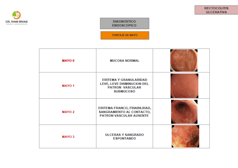 Algoritmos de buena práctica en diagnóstico y tratamiento de colitis ...